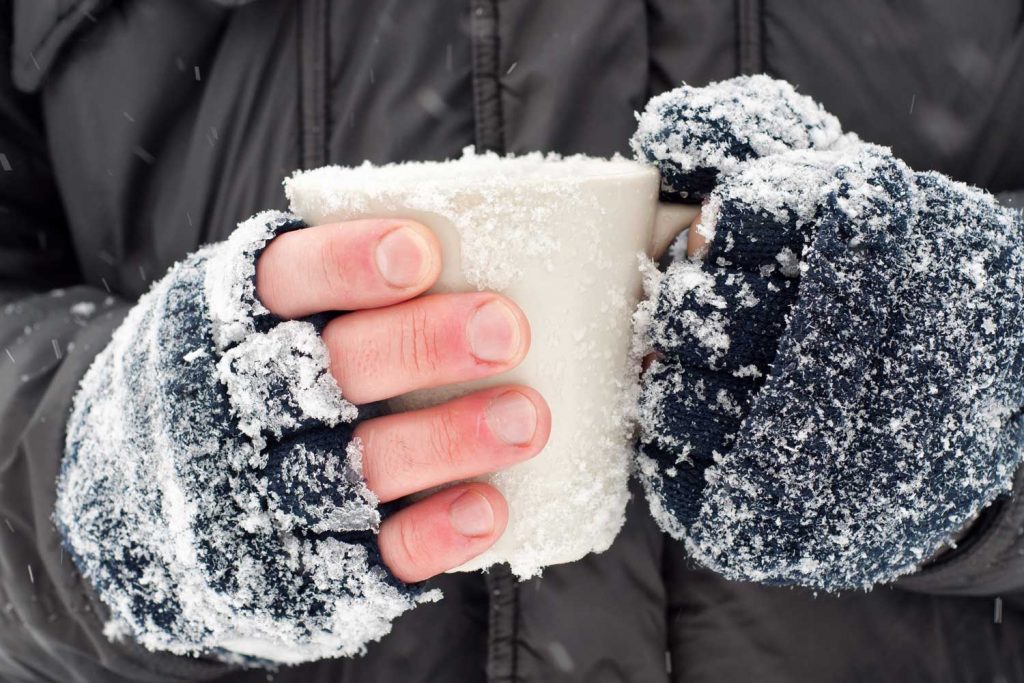 5 Ways To Look After Dry Hands This Winter: Top Tips From A ...